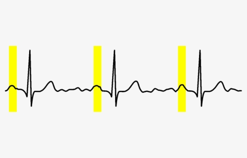 Python Matplotlib Plot Sphere , Free Transparent Clipart - ClipartKey