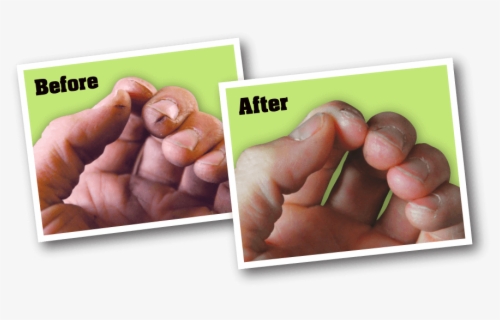 Jason Vale Before And After , Free Transparent Clipart - ClipartKey