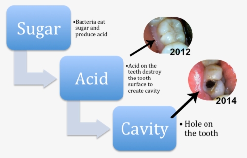 Number 14 Clipart , Free Transparent Clipart - ClipartKey