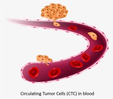 Metastasis - Metastasis Simple , Free Transparent Clipart - ClipartKey