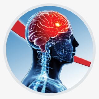 Heat Oppressed Brain , Free Transparent Clipart - ClipartKey