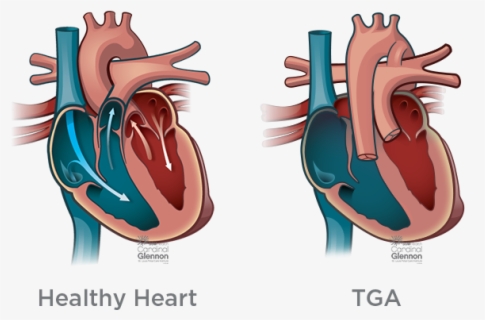 Tga - Transposition Tga , Free Transparent Clipart - ClipartKey