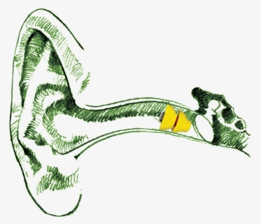 Hearing Aid Hearing Loss - Hearing Aid Illustrations , Free Transparent ...