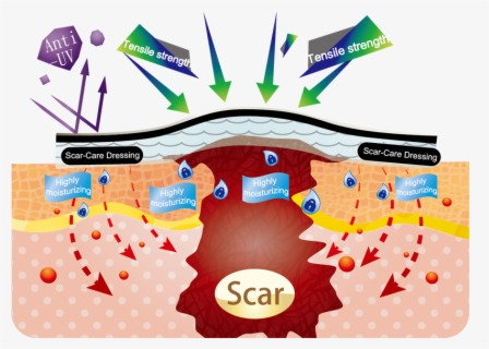 Transparent Scar Wound Clipart , Free Transparent Clipart - ClipartKey