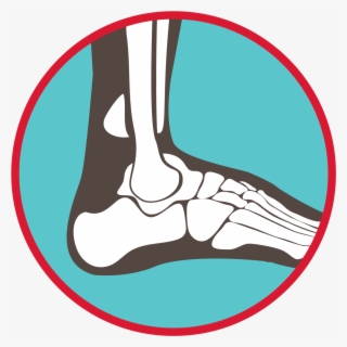 Bones Of The Ankle And Foot Graphic - Ankle Graphic , Free Transparent Clipart - ClipartKey