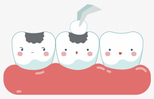Dental Filling Cartoon , Free Transparent Clipart - ClipartKey