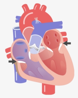 Av Valves Opening Animation Slide - Circulation System Cartoon , Free ...