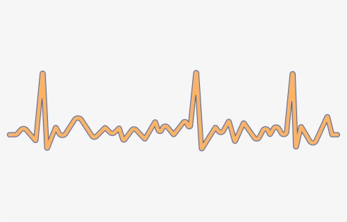 Atrial Fibrillation Clip Art , Free Transparent Clipart - ClipartKey