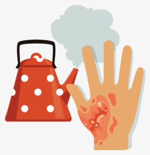 Burns First Aid Cartoon , Free Transparent Clipart - ClipartKey