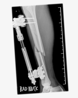 Break A Leg T Shirt Template Copy Small - X-ray , Free Transparent ...