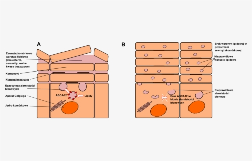 Clip Art Diagram Of Another Wiring - Harlequin Ichthyosis Vs Normal ...