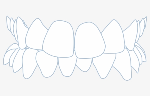 Bite - Drawing , Free Transparent Clipart - ClipartKey