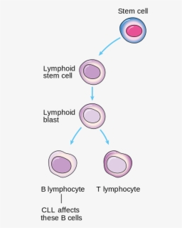 Acute Myeloid Leukemia Aml , Free Transparent Clipart - ClipartKey