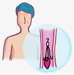 Complications Clipart Circle - Complication Icon Clipart Transparent ...