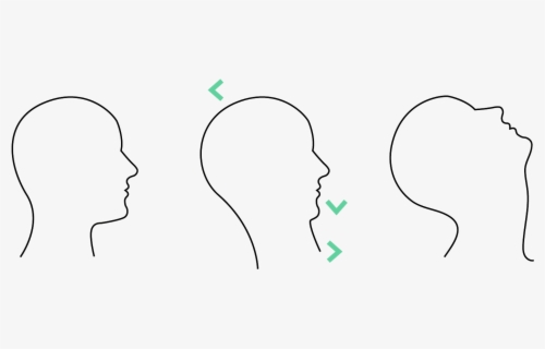 Concussions Png , Free Transparent Clipart - ClipartKey