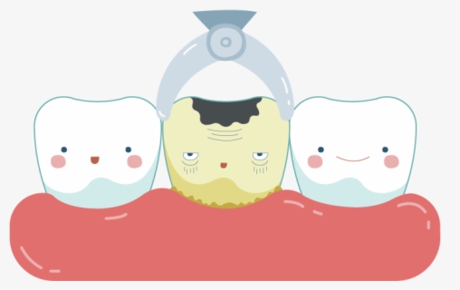 Dental Filling Cartoon , Free Transparent Clipart - ClipartKey