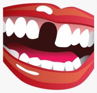 Tooth Svg Smiley - Missing Tooth Emoji Transparent , Free Transparent ...