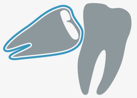 Wisdom Teeth Removal , Free Transparent Clipart - ClipartKey