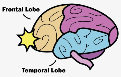 The Anatomy Of A Concussion - Frontal And Temporal Lobes Concussion ...